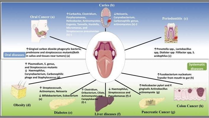 Oral Bacteria... Connected to Other Health Conditions? | Other Omaha NE